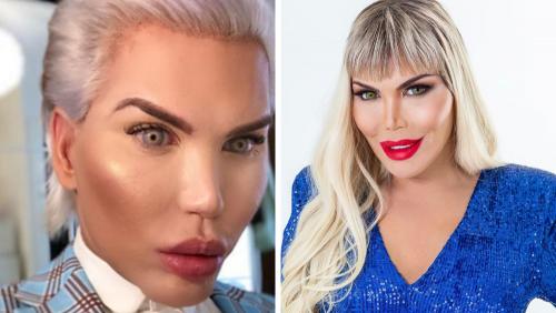 Żywy Ken został… Żywą Barbie! Rodrigo Alves zmienił płeć - 4FUN.TV